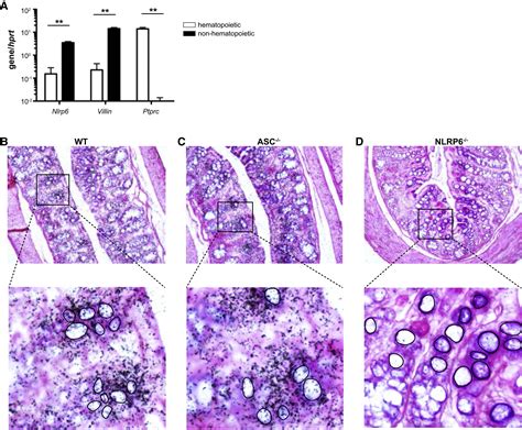 Nlrp6 Inflammasome Orchestrates The Colonic Host Microbial Interface By