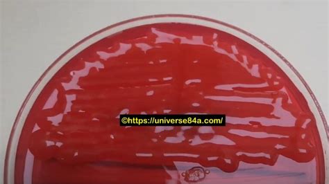 Enterobacter Cloacae Introduction Morphology Pathogenicity Lab