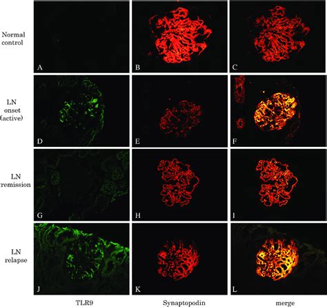 Double Immunofluorescence Staining For Tlr9 And Synaptopodin In Ln And
