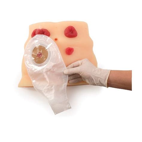 Ostomy Care Training Model 26130 Health Edco Stoma Trainer Ostomy