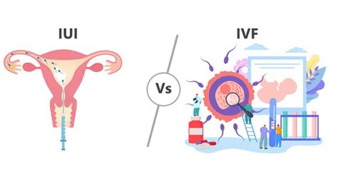 Iui Vs Ivf Which Fertility Treatment Option Is Right For You