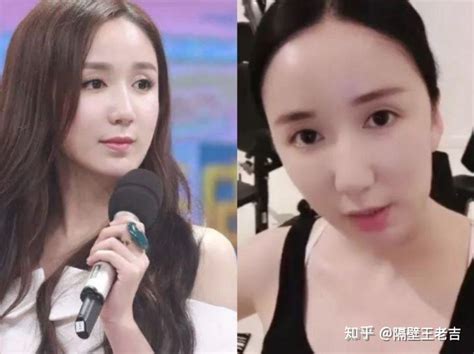 脂肪填充、热玛吉、线雕、超声刀到底怎么选？女明星抗衰老的秘诀都在这篇文章里了 知乎