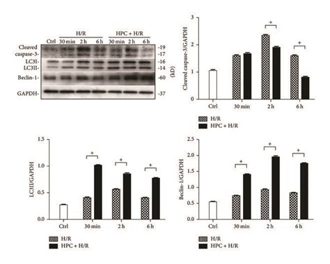 Hypoxic Preconditioning Hpc Induced Autophagy And Reduced Apoptosis