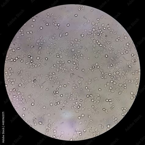 Sperm Morphology Semen Photo Under Microscope Micrograph Showing