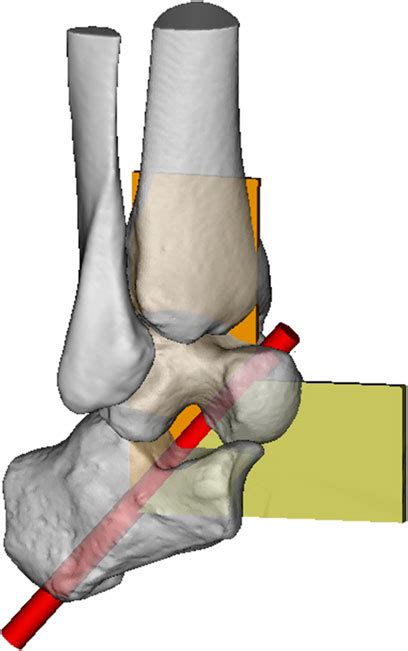 Frontiers Role Of The Intrinsic Subtalar Ligaments In Subtalar