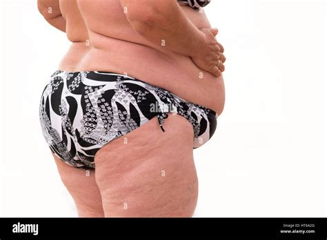 Fat Woman Swimsuit Overweight Banque De Photographies Et Dimages à