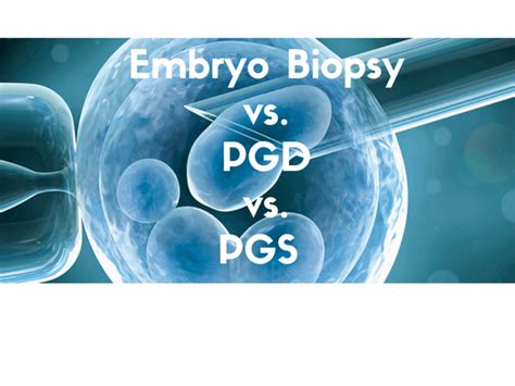 Embryo Biopsy Vs Pgd Preimplantation Genetic Diagnosis Vs Pgs