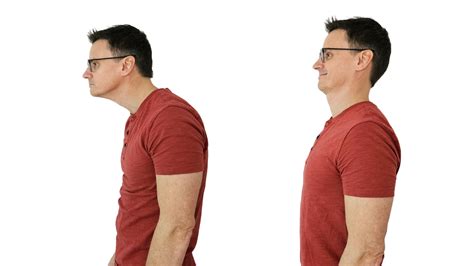 How To Fix Forward Head Posture In 4 Minutes Chiropractic On Eagle