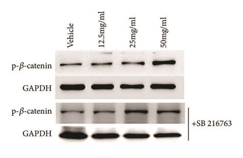Activating Wnt β Catenin Pathway Rescued The Level Of β Catenin Emt