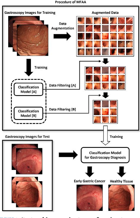 Figure 1 From Enhanced Classification Of Gastric Lesions And Early
