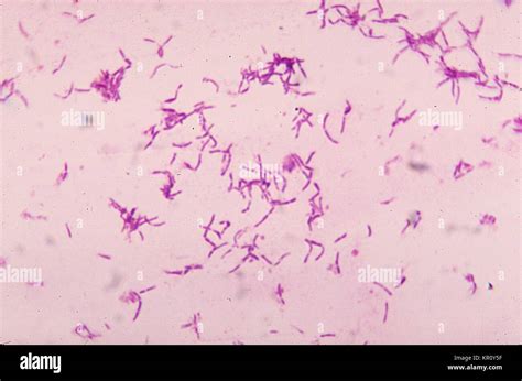 Esta Micrografía Muestra La Bacteria Gram Positivas Bifidobacterium