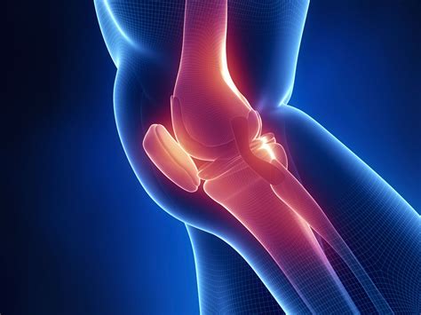 Privatpraxis Für Orthopädie And Sportmedizin In Dortmund Orthopädie
