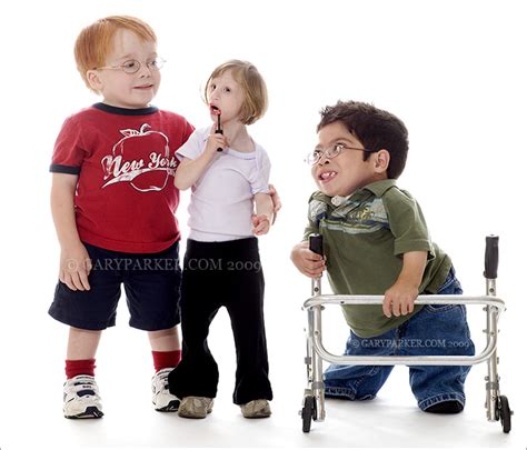 Different Types Different Types Of Dwarfism