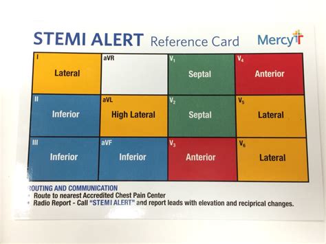 Best Way To Learn 12 Lead Ecg Just For Guide