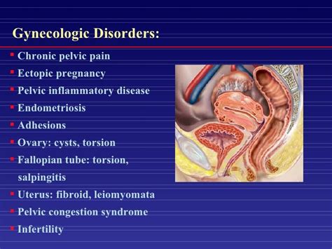 Diagnostic Laparoscopy For Pelvic Disorders