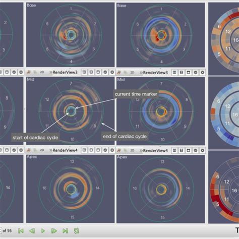 Coordinated Views Of Spatio Temporal Views Of Individual Slices 3 × 3