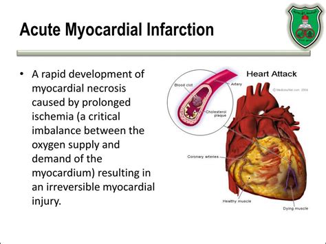 Ppt Biomarkers Of Myocardial Infarction Powerpoint Presentation Free