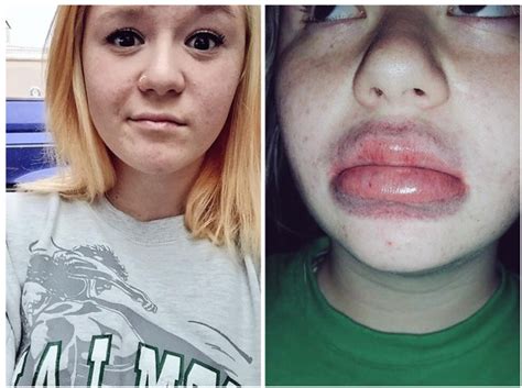 And Of Course The Most Horrifying Trend Of The Year The Kylie Jenner