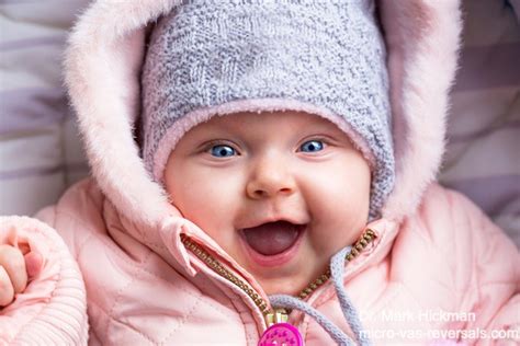 Austin Texas Vasectomy Reversal Operation Affordable Vasectomy Reversals