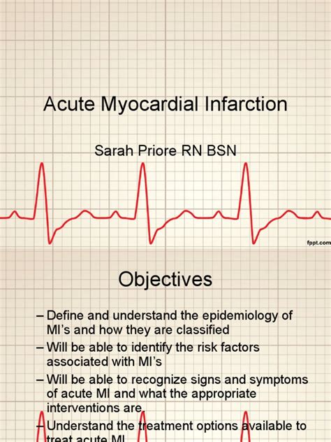 Understanding Acute Myocardial Infarction Risk Factors Signs