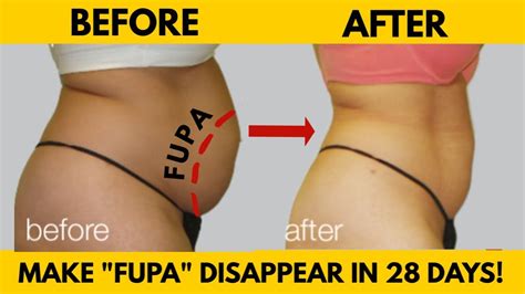😱 28 Day Fupa Challenge 🚫 Stop Hiding Your Fupa And Get Rid Of Fupa In 28