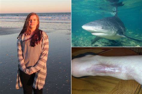 Sharks Attacking People In Real Life