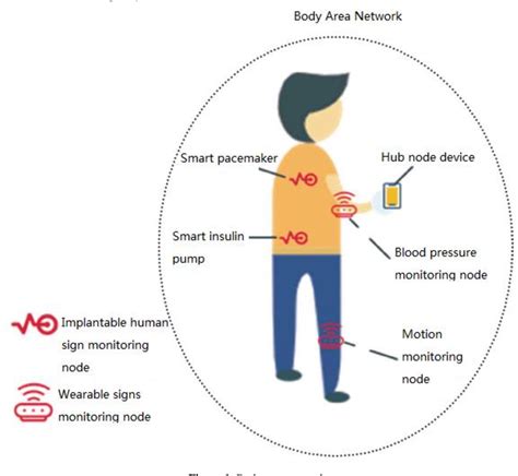 Figure 1 From Research Status And Progress Of Intelligent Wearable