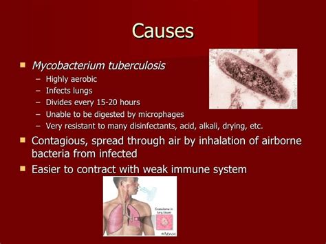 Tuberculosis Presentation
