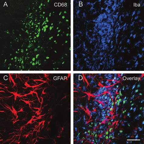 Concomitant Immunofluorescence Staining Of Cd68 In Macrophage Like