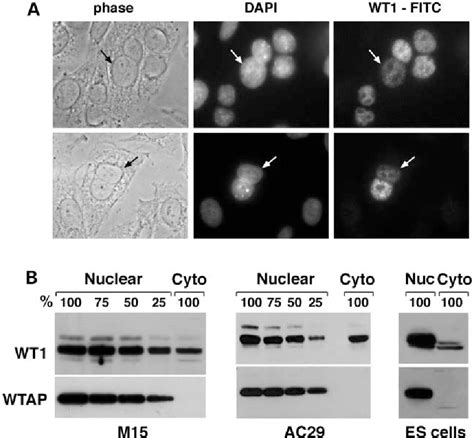 Figure 1 From The Wilms Tumour Protein Wt1 Shuttles Between Nucleus