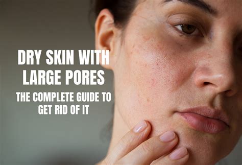 Dry Skin With Large Pores The Complete Guide To Get Rid Of It