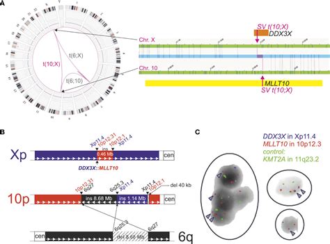 Frontiers Broad Genomic Workup Including Optical Genome Mapping