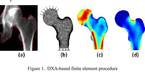 Figure 1 From Investigation Of Repeatability In Hip Fracture Risk