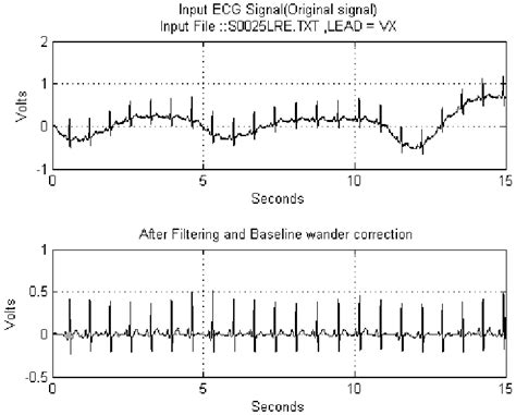 signal filtering and baseline wander correction download scientific