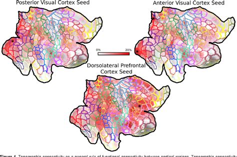 Figure 4 From Topographic Mapping As A Basic Principle Of Functional