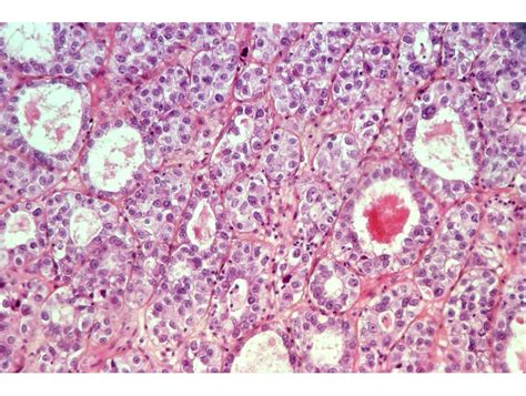 Histopathology And Cytopathology Of The Uterine Cervix Digital Atlas