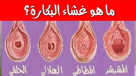 ما هو غشاء البكارة؟ ما هي انواع غشاء البكارة؟ Youtube