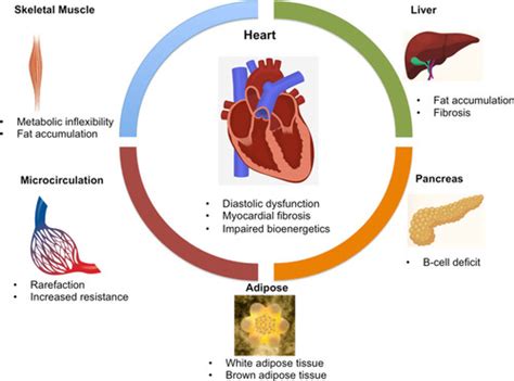 Multiorgan Multimodality Imaging In Cardiometabolic Disease