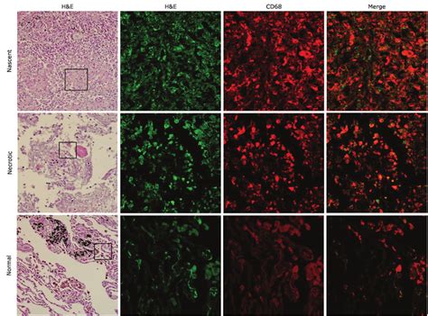 Signals And Co Localization Of Neuron Specific Enolase Nse And Tissue