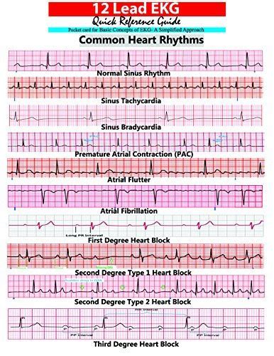 12 Lead Ekg Pocket Card By Aprn World