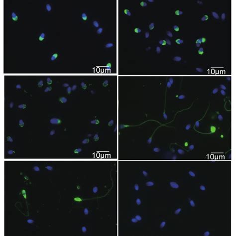 Immunofluorescent Staining Of Normal Human Sperm With Hs Monoclonal