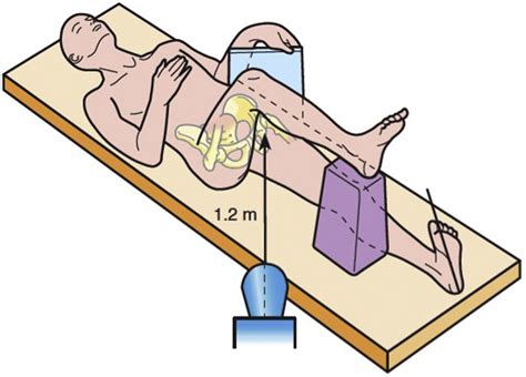 The Value Of The Direct Lateral Hip Radiograph In An Adult