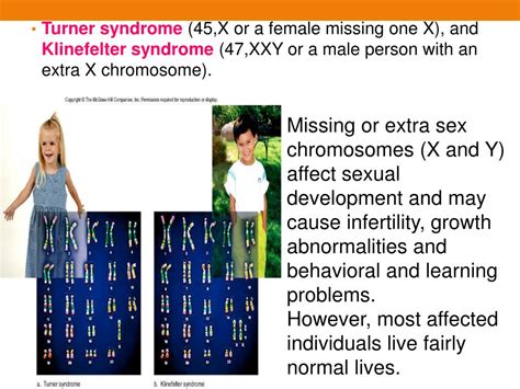 ppt birth defects powerpoint presentation free download