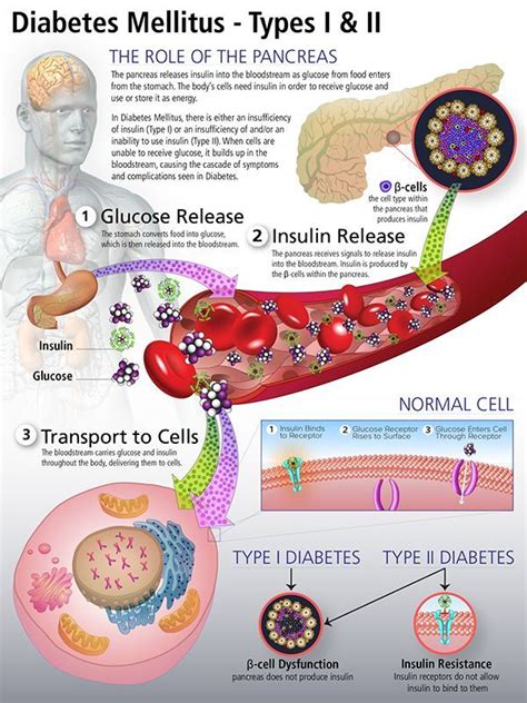 Diabetes Mellitus On Behance Nursing School Survival Medical