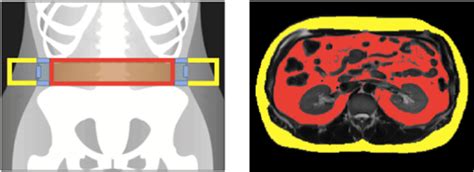 Analysis Methods For Adipose Tissue Estimation Or Quantification Dxa