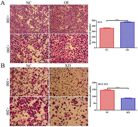 Inpp4b Regulates Gc Cell Migration As Demonstrated By A Transwell