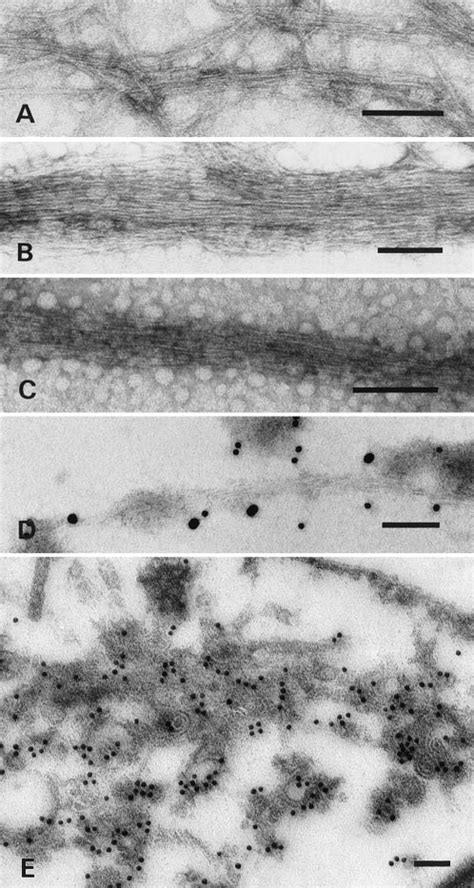 Electron Microscopic Examination Of Fibrils And Infected Sf9 Cells A