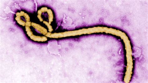 Deadliest Ever Outbreak Of Ebola Virus What To Know Cnn