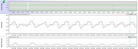 asv settings for treatment of complex sleep apnea apnea