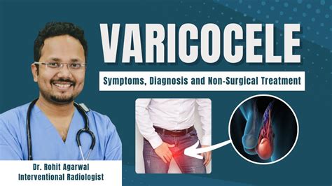 जानें क्या है वैरीकोसिल Varicocele Symptoms Diagnosis Non Surgical